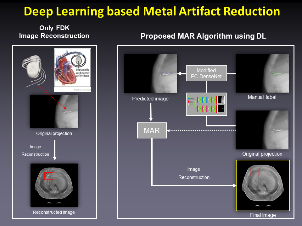 Advanced Ct Reconstruction 1 페이지 Mpbel 연세 의학물리 및 의공학 연구실