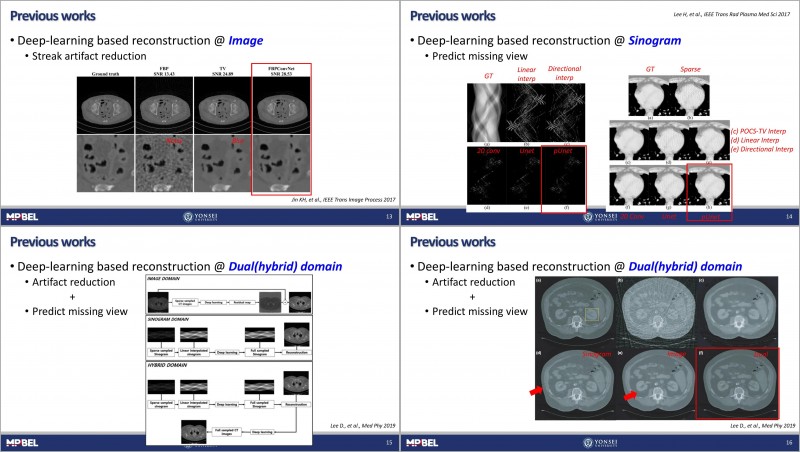 [Journal Club] A streak artifact reduction algorithm in sparse-view CT > Seminar | MPBEL | 연세 의학 ...