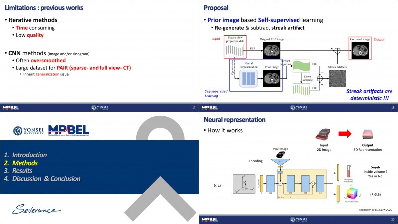 [Journal Club] A streak artifact reduction algorithm in sparse-view CT > Seminar | MPBEL | 연세 의학 ...