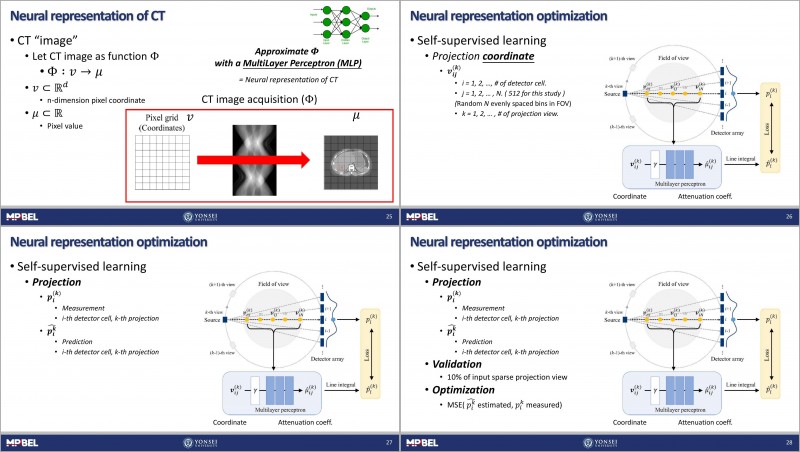 [Journal Club] A streak artifact reduction algorithm in sparse-view CT > Seminar | MPBEL | 연세 의학 ...