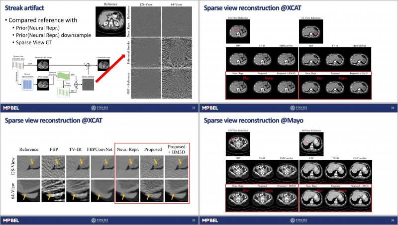 [Journal Club] A streak artifact reduction algorithm in sparse-view CT > Seminar | MPBEL | 연세 의학 ...